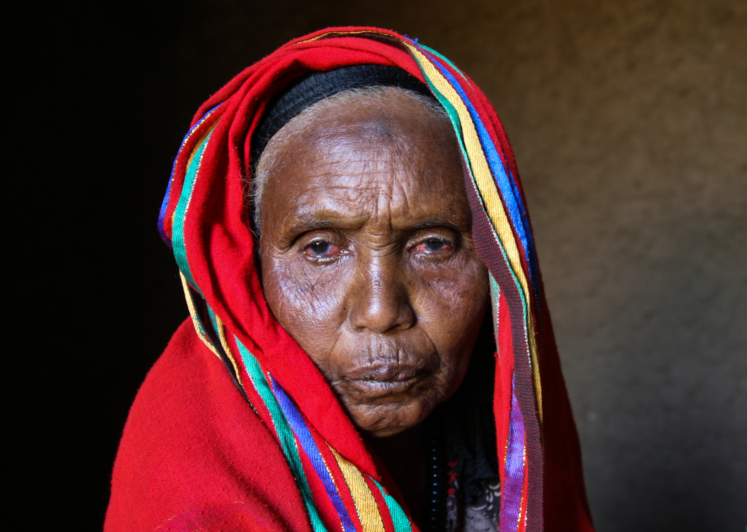 Amina Ahmed at home in Oromo, Ethiopia. Before having cataracts removed ...